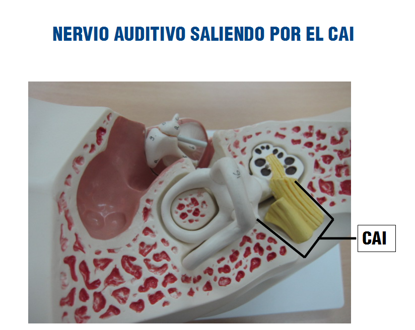 Conducto auditívo interno (CAI).