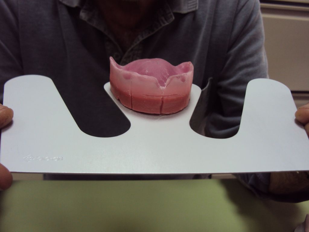 Anexo I.- Pasos y visitas del paciente en la elaboración de una ...