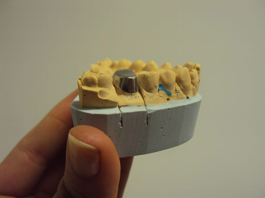 2.4.3.- Elaboración clínica de fundas y puentes fijos. 2º día. | P002 ...