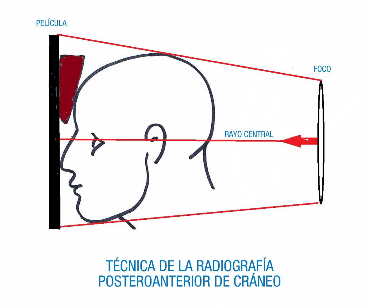 1.16.- Técnicas radiográficas extraorales. Telerradiografía o ...